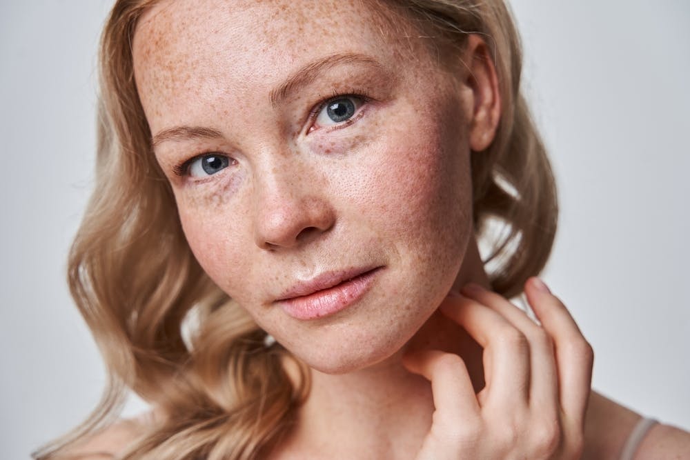 How Curcumin Can Transform Your Skincare Routine